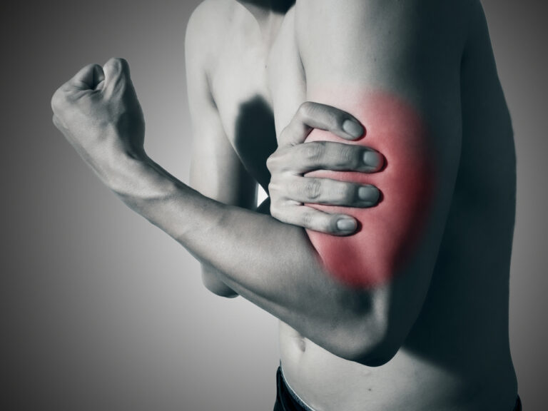 Bicepstendinit – Kraftsportkliniken